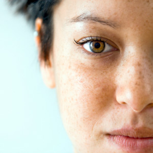 Understanding Freckles: A Comprehensive Guide | Mytour