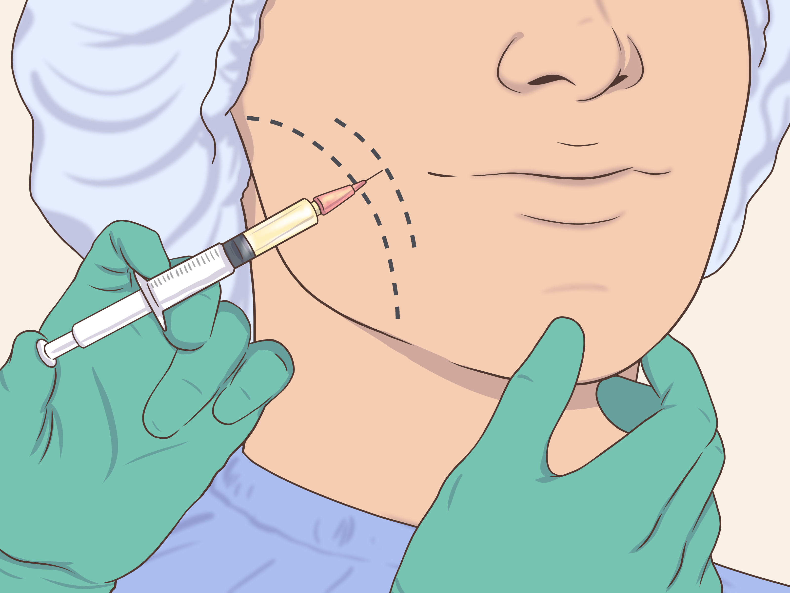 16 Different Types of Dimples: Exploring Every Kind of Face and Body Dimple